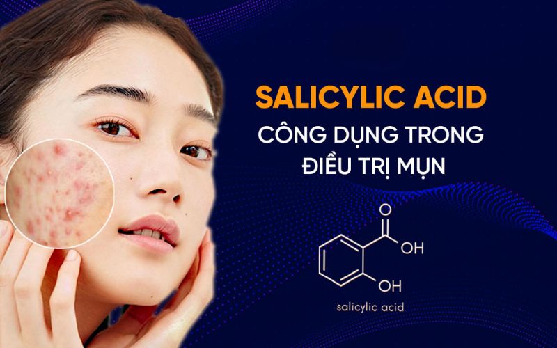 Salicylic Acid 99% TN - C7H6O3 (Axit Salicylic thí nghiệm)